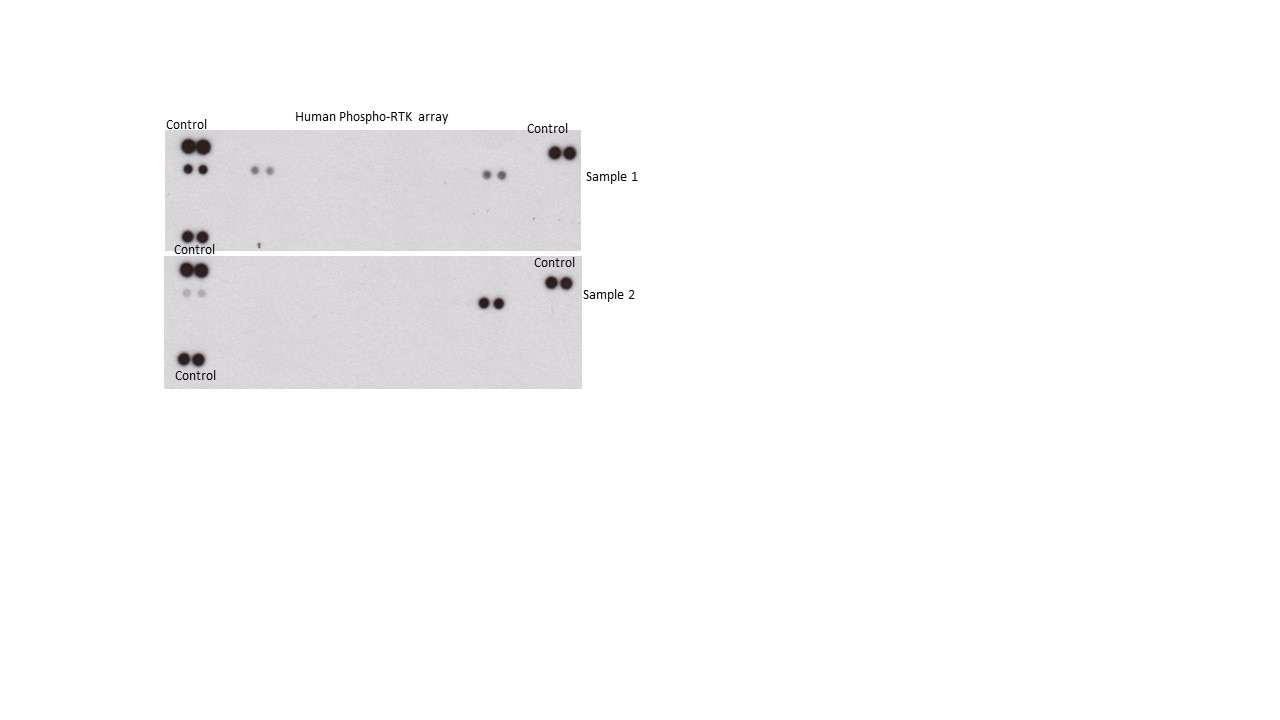 Proteome Profiler Human Phospho-RTK Array Kit (ARY001B) | Bio-Techne