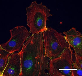 Anti-alpha Smooth Muscle Actin Antibody MAB1420: R&D Systems