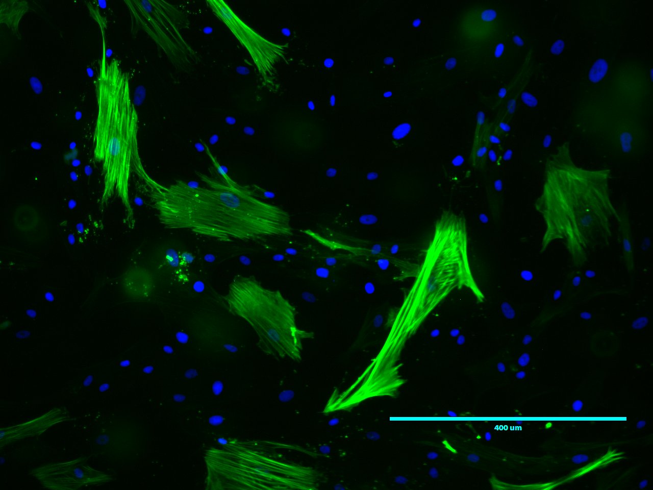 Anti-alpha Smooth Muscle Actin Antibody MAB1420: R&D Systems